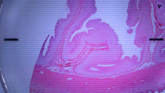 Review: DARWIN M2 Digital Microscope from Beaverlab - wildmacro ...